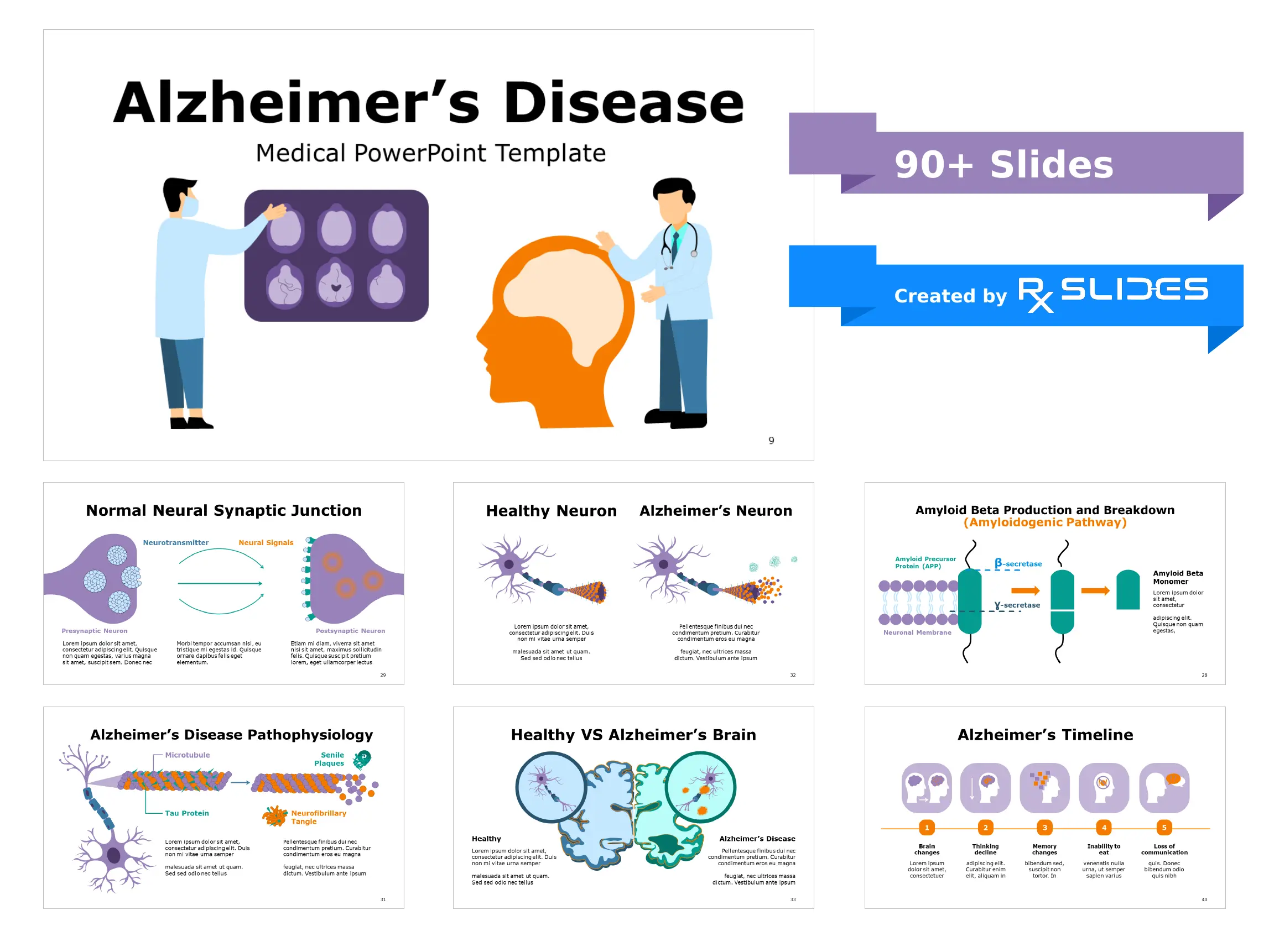 Download Alzheimer's Disease PowerPoint Template| RxSlides